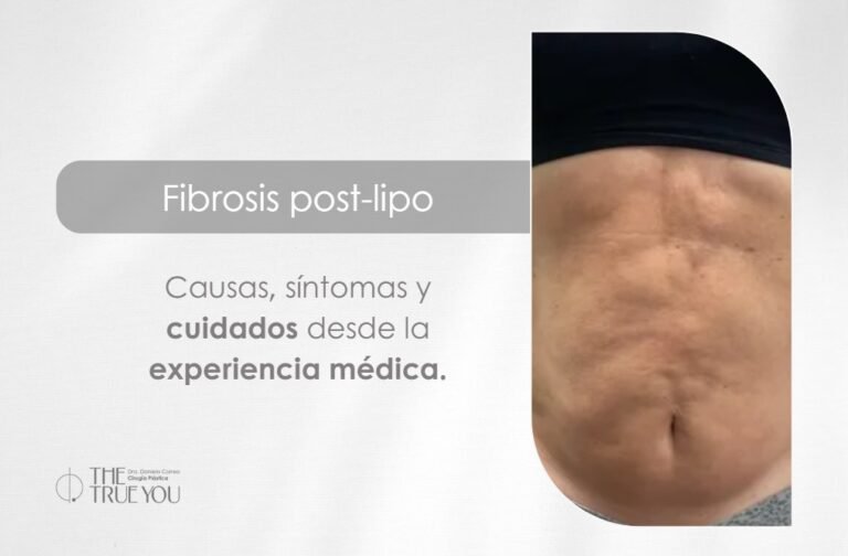 Fibrosis post-lipo: señales de alerta y cuidados